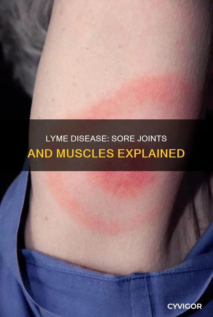 Lyme Disease: Sore Joints And Muscles Explained | CyVigor