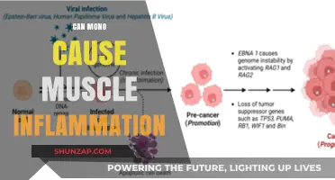 How Mono Triggers Muscle Aches And Pains | CyVigor