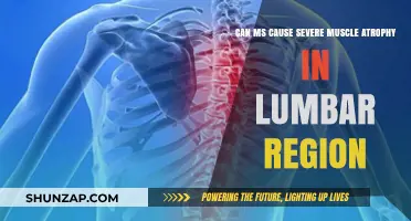 Ms And Leg Issues: Fasciculations And Atrophy | CyVigor