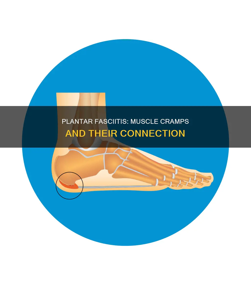 Plantar Fasciitis: Muscle Cramps And Their Connection | CyVigor