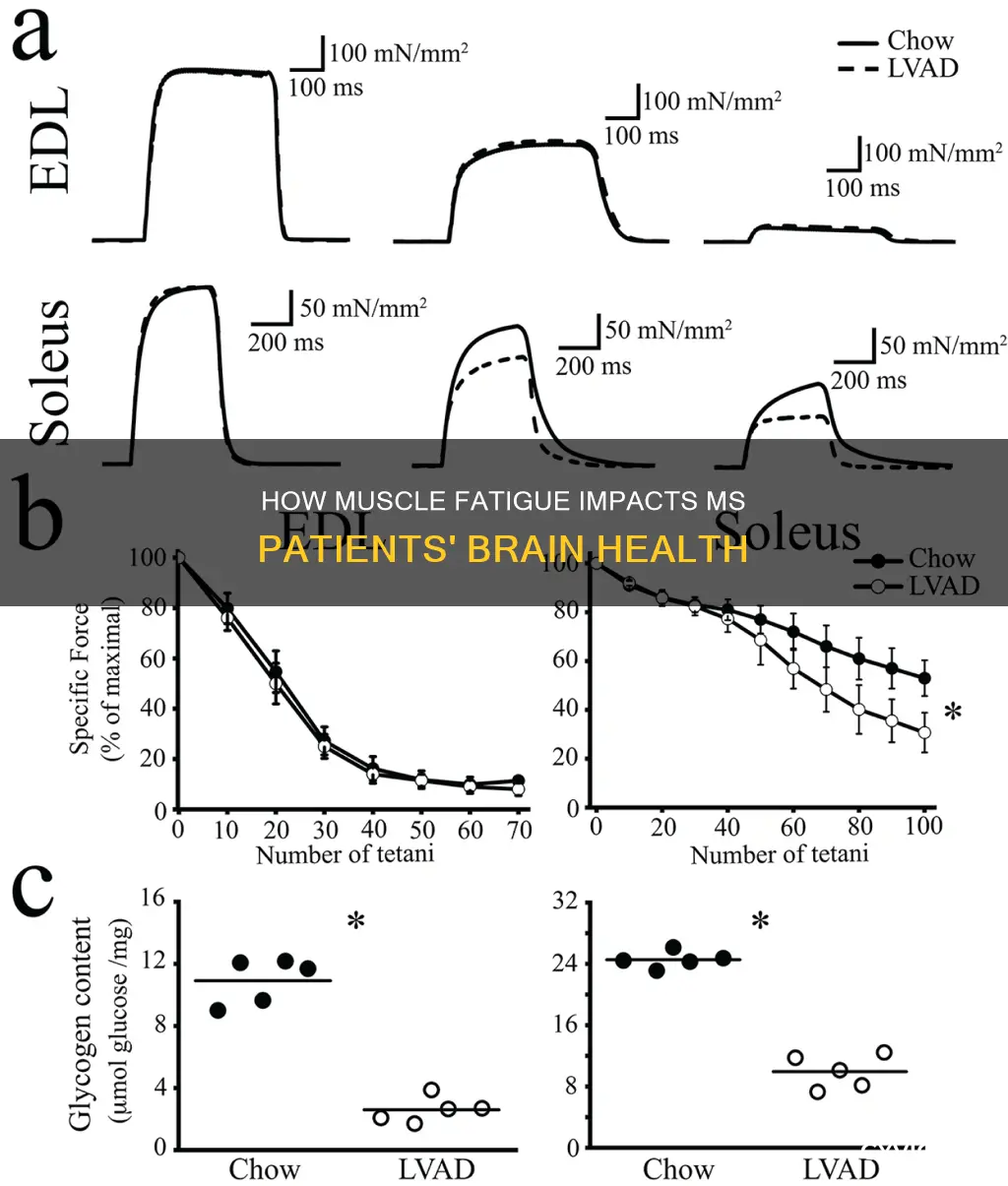 How Muscle Fatigue Impacts Ms Patients' Brain Health | CyVigor