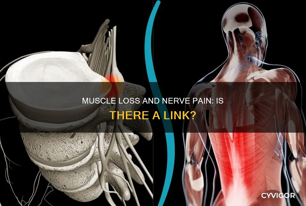 Muscle Loss And Nerve Pain: Is There A Link? | CyVigor