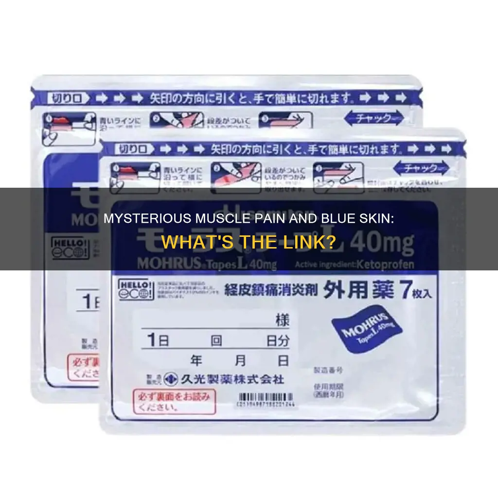 Mysterious Muscle Pain And Blue Skin: What's The Link? | CyVigor