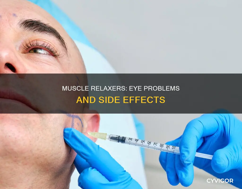 Muscle Relaxers: Eye Problems And Side Effects | CyVigor