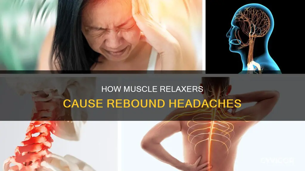 How Muscle Relaxers Cause Rebound Headaches | CyVigor