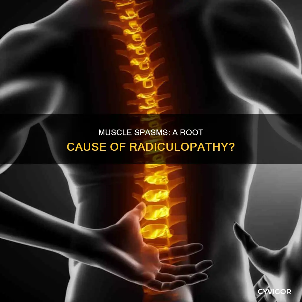 Muscle Spasms: A Root Cause Of Radiculopathy? | CyVigor