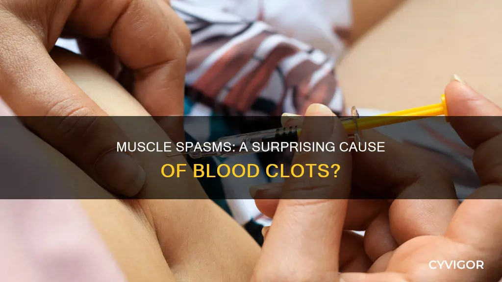 Muscle Spasms: A Surprising Cause Of Blood Clots? | CyVigor