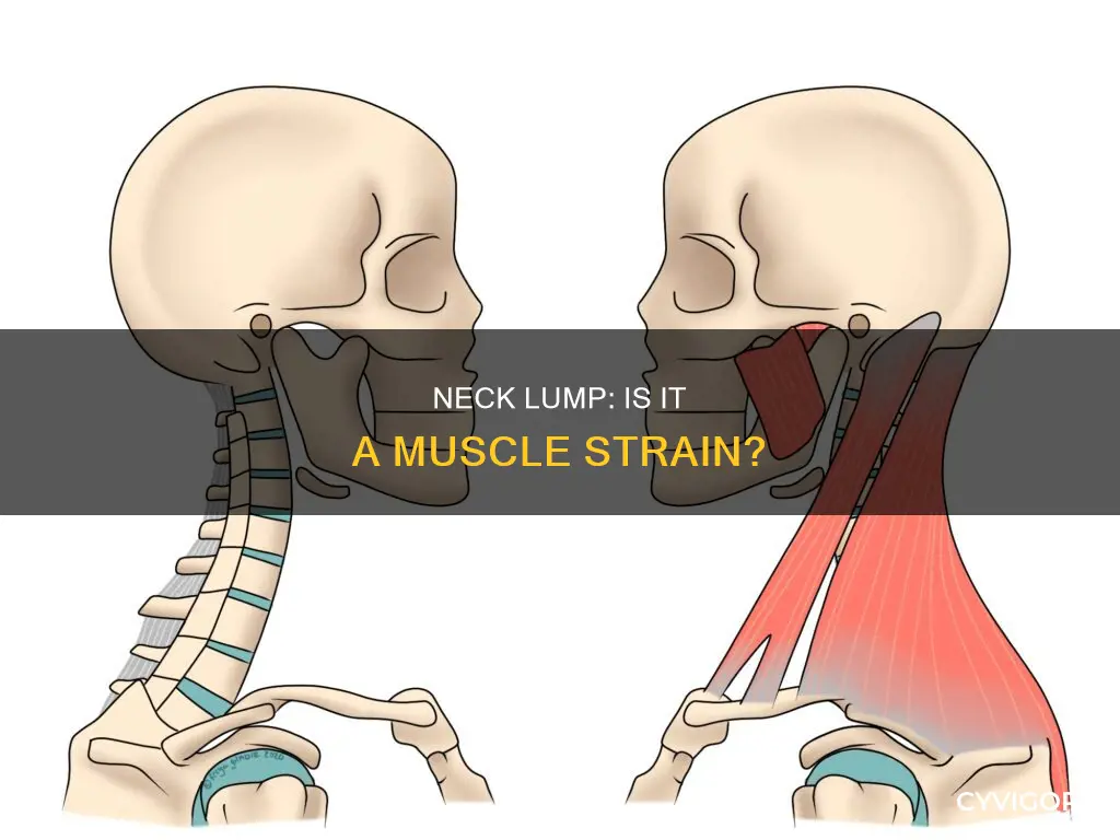 Neck Lump: Is It A Muscle Strain? | CyVigor