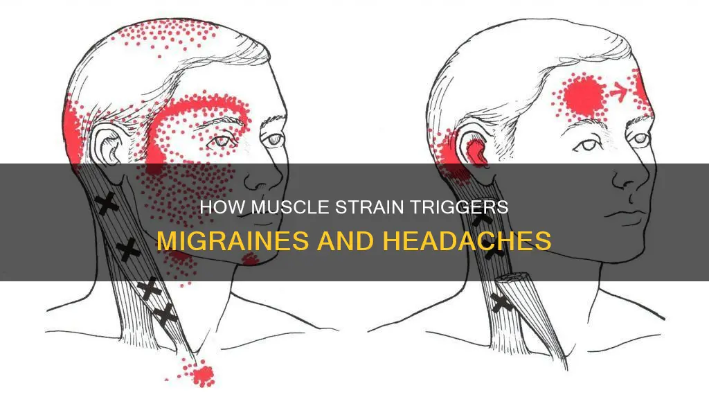 How Muscle Strain Triggers Migraines And Headaches | CyVigor