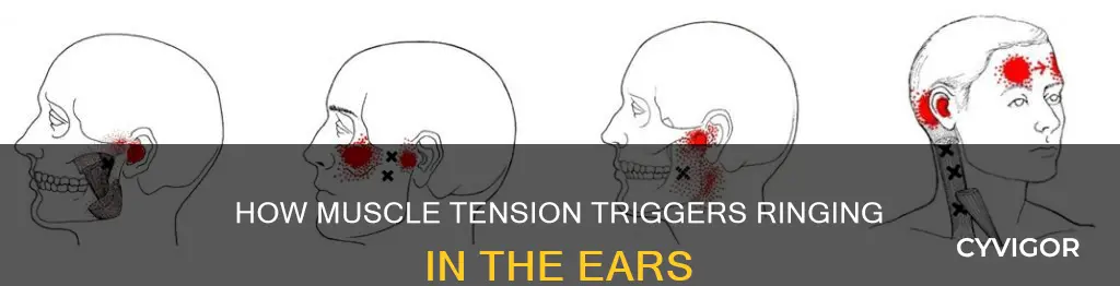 How Muscle Tension Triggers Ringing In The Ears | CyVigor