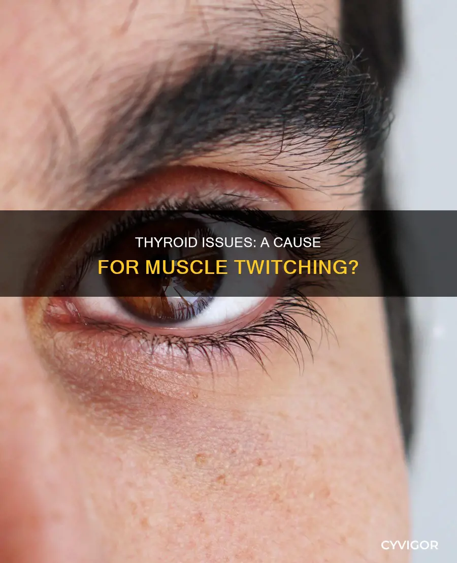 Thyroid Issues: A Cause For Muscle Twitching? | CyVigor