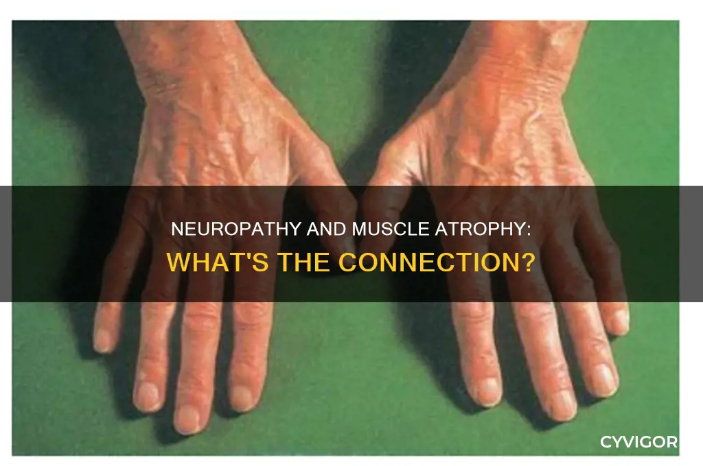 Neuropathy And Muscle Atrophy: What's The Connection? | CyVigor