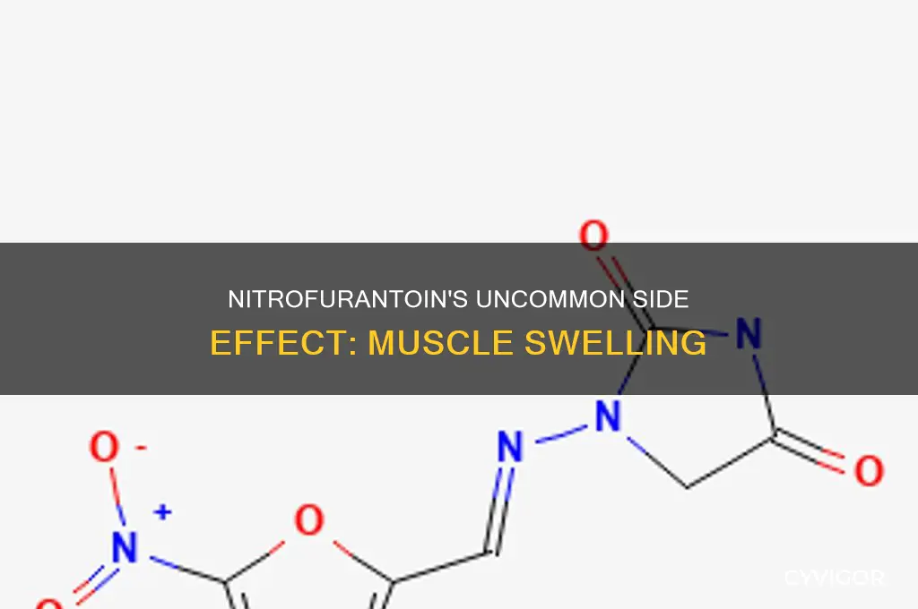 Nitrofurantoin's Uncommon Side Effect: Muscle Swelling | CyVigor