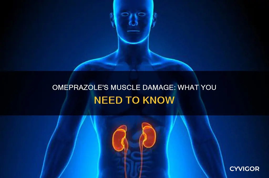 Omeprazole's Muscle Damage: What You Need To Know | CyVigor