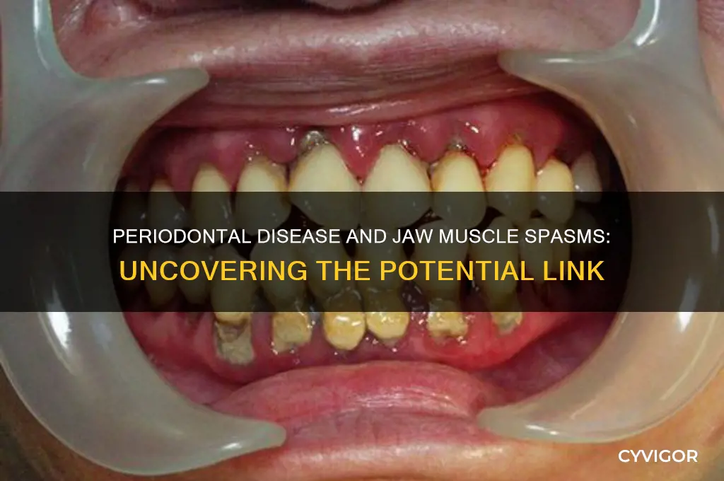Periodontal Disease And Jaw Muscle Spasms: Uncovering The Potential ...