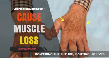 Peripheral Neuropathy And Muscle Atrophy: Understanding The Connection ...