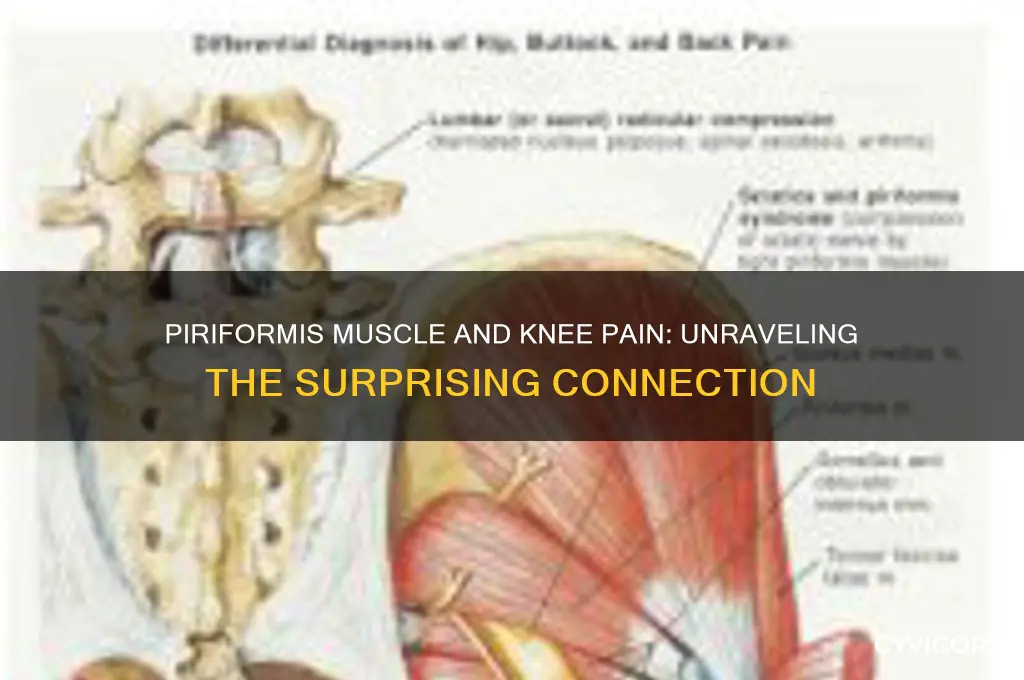 Piriformis Muscle And Knee Pain: Unraveling The Surprising Connection ...