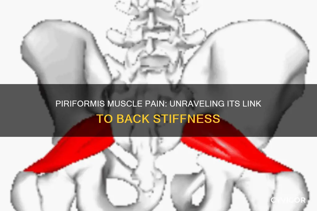 Piriformis Muscle Pain: Unraveling Its Link To Back Stiffness | CyVigor