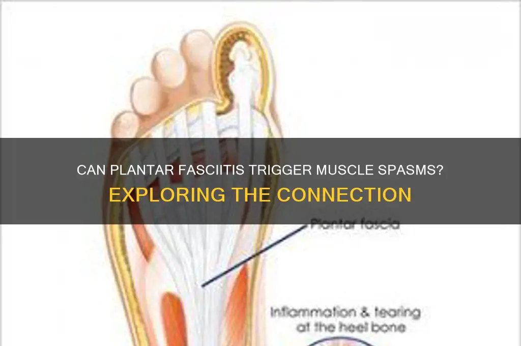 Can Plantar Fasciitis Trigger Muscle Spasms? Exploring The Connection ...