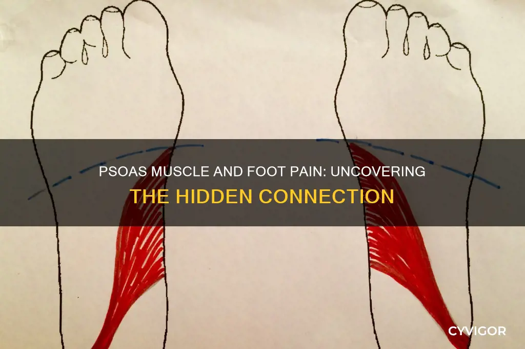 Psoas Muscle And Foot Pain: Uncovering The Hidden Connection | CyVigor