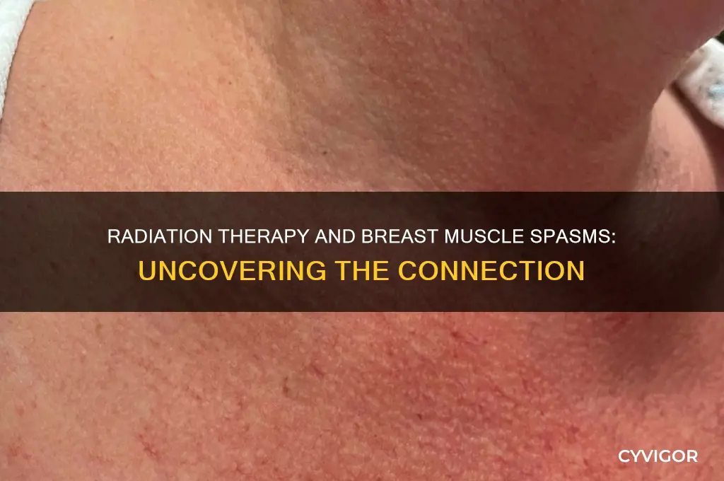 Radiation Therapy And Breast Muscle Spasms: Uncovering The Connection ...