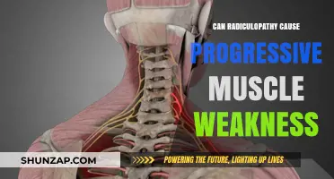 Radiculopathy And Muscle Spasms: Understanding The Connection And ...