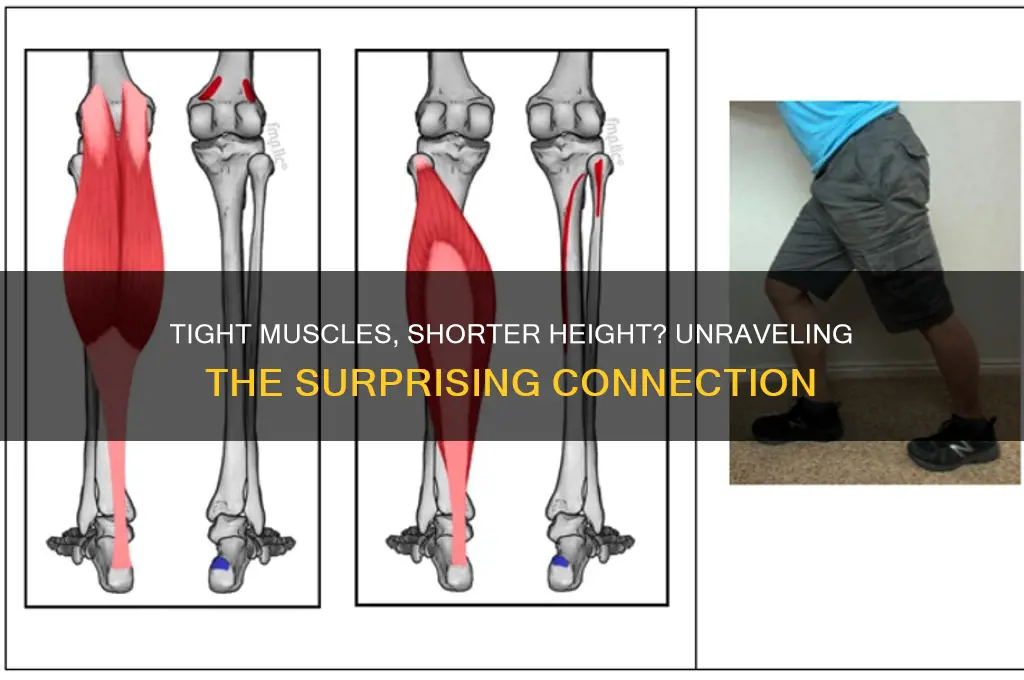 Tight Muscles, Shorter Height? Unraveling The Surprising Connection ...