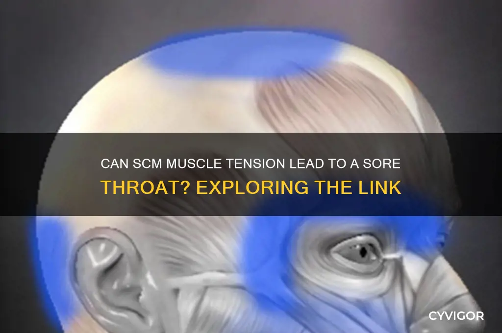 Can Scm Muscle Tension Lead To A Sore Throat? Exploring The Link | CyVigor