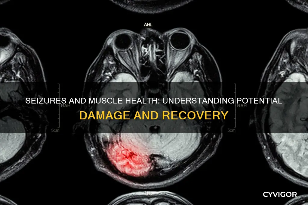 Seizures And Muscle Health: Understanding Potential Damage And Recovery ...