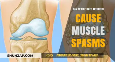 Severe Muscle Spasms: Understanding Risks Of Long-Term Damage And ...