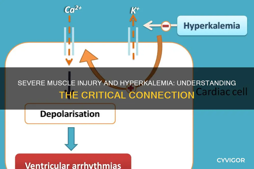 Severe Muscle Injury And Hyperkalemia: Understanding The Critical ...
