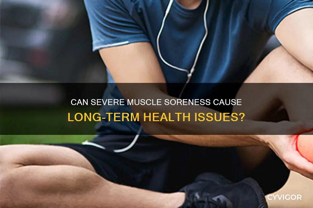 Can Severe Muscle Soreness Cause Long-Term Health Issues? | CyVigor