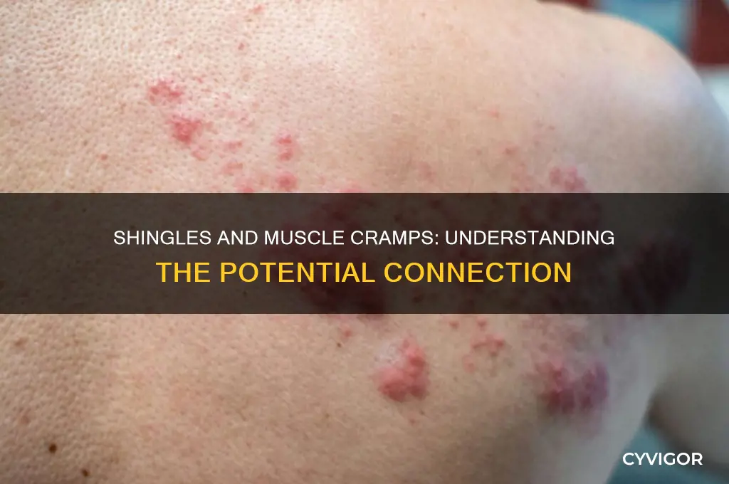 Shingles And Muscle Cramps: Understanding The Potential Connection ...