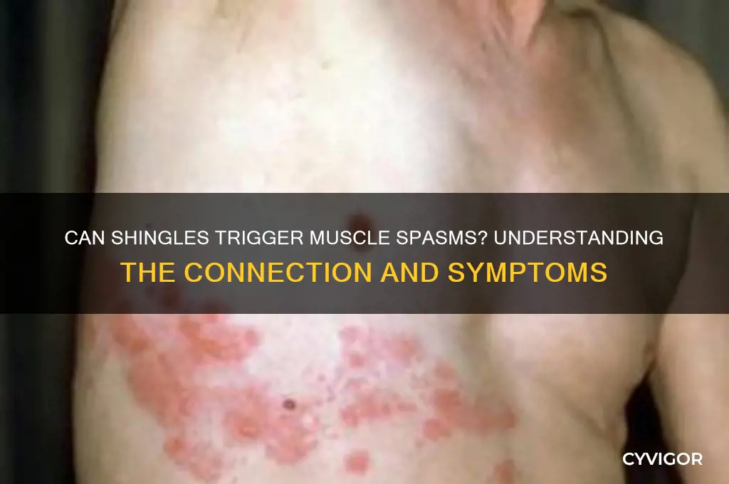 Can Shingles Trigger Muscle Spasms? Understanding The Connection And ...