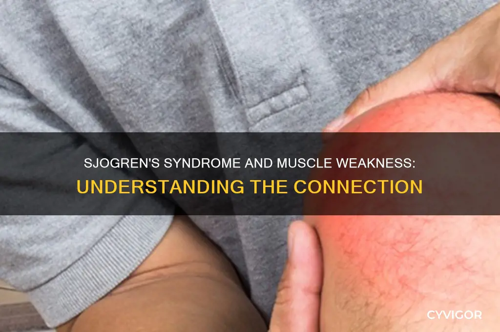 Sjogren's Syndrome And Muscle Weakness: Understanding The Connection ...