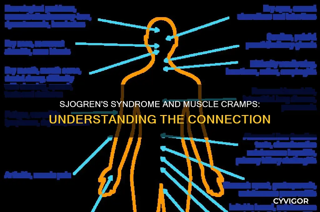 Sjogren's Syndrome And Muscle Cramps: Understanding The Connection ...