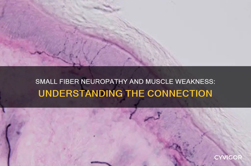 Small Fiber Neuropathy And Muscle Weakness: Understanding The ...