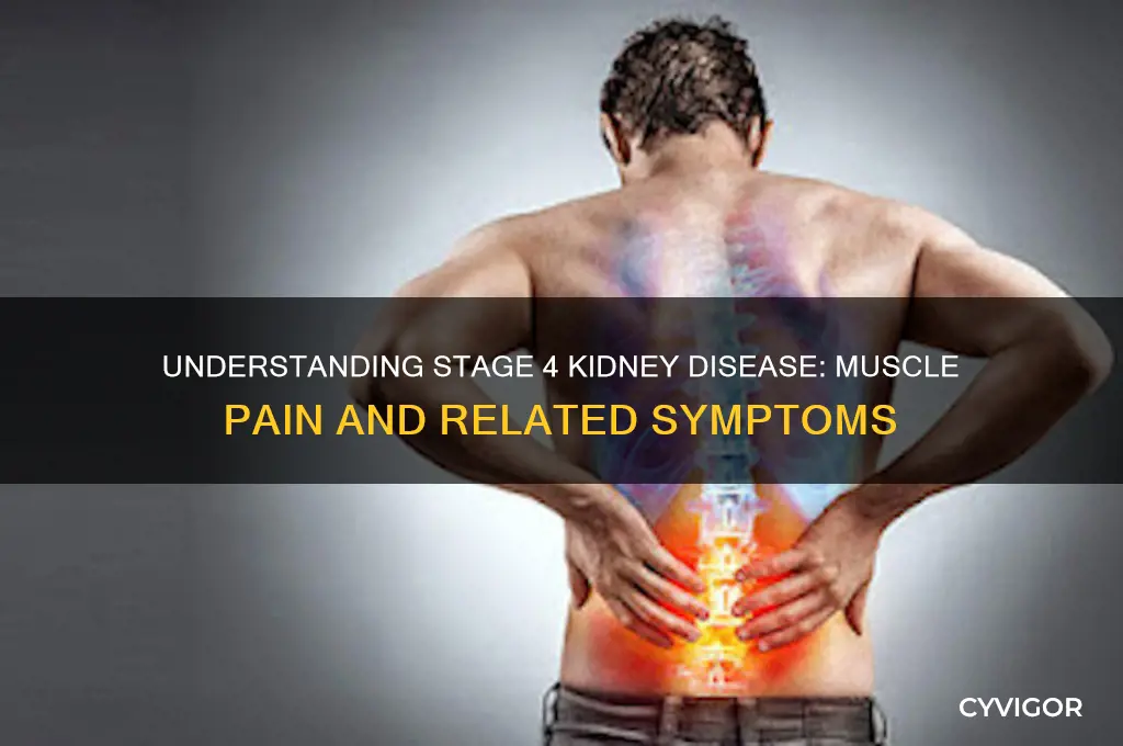 Understanding Stage 4 Kidney Disease: Muscle Pain And Related Symptoms ...