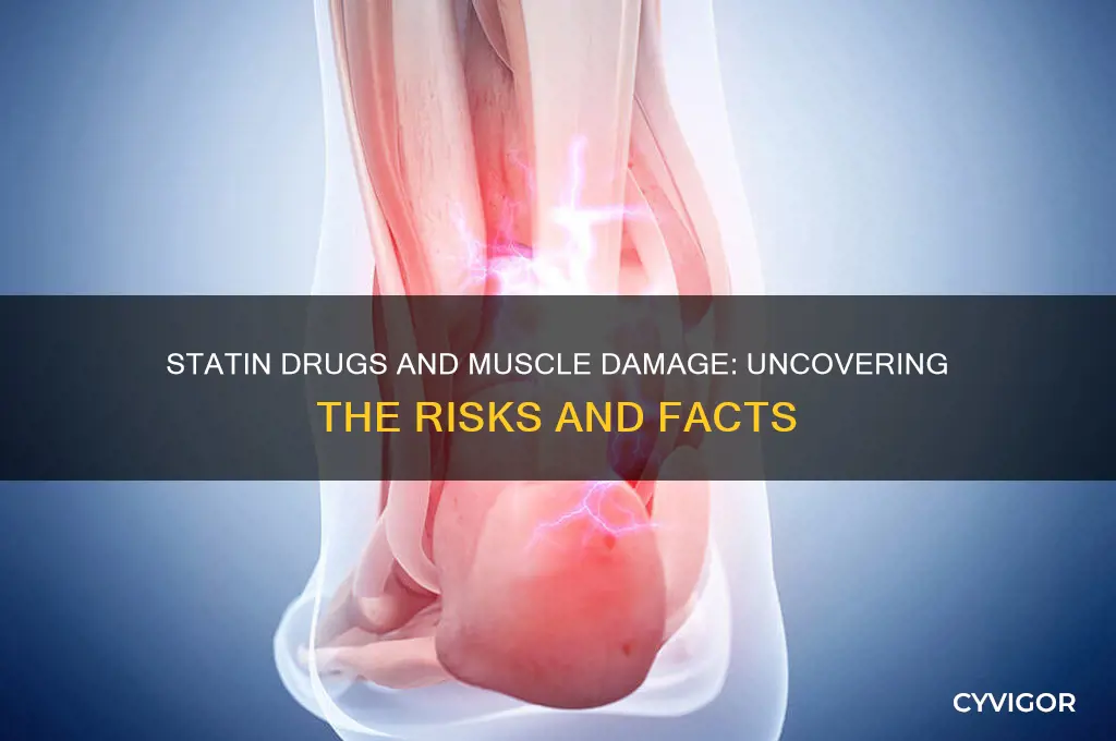 Statin Drugs And Muscle Damage: Uncovering The Risks And Facts | CyVigor