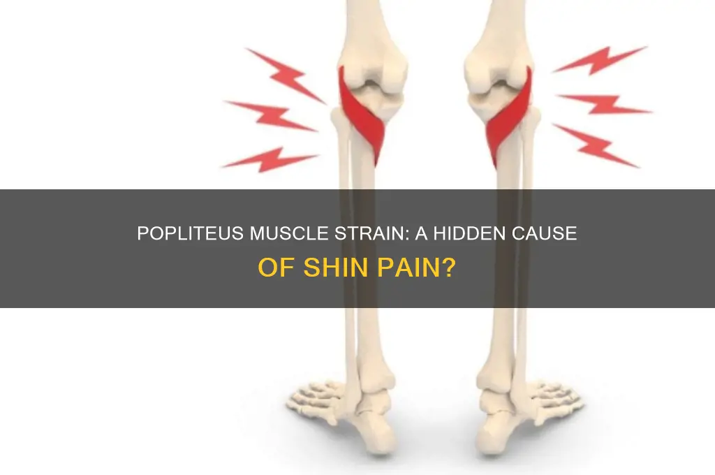 Popliteus Muscle Strain: A Hidden Cause Of Shin Pain? | CyVigor