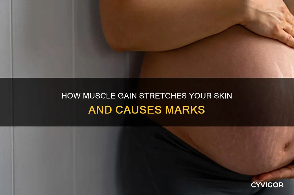 How Muscle Gain Stretches Your Skin And Causes Marks | CyVigor