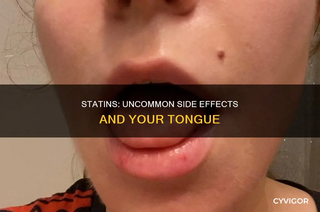 Statins: Uncommon Side Effects And Your Tongue | CyVigor