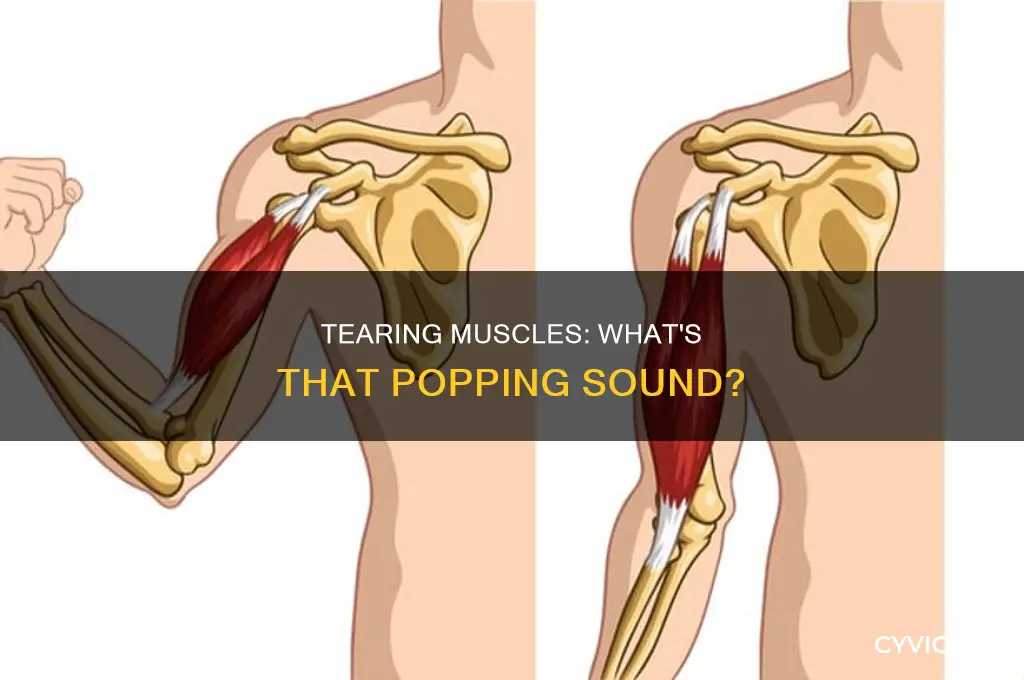 Tearing Muscles: What's That Popping Sound? | CyVigor