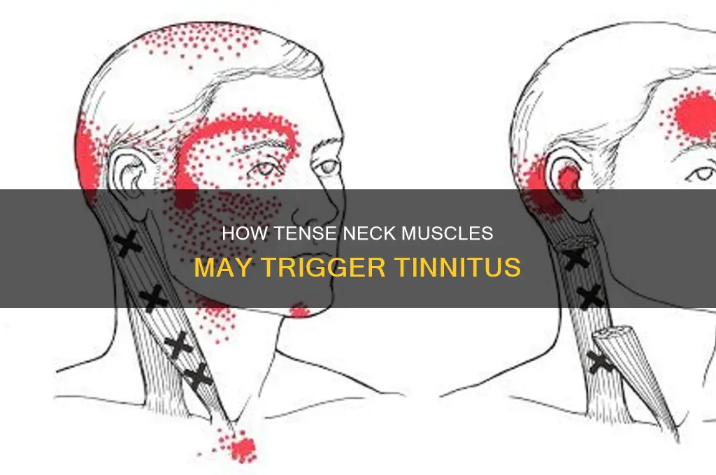 How Tense Neck Muscles May Trigger Tinnitus | CyVigor