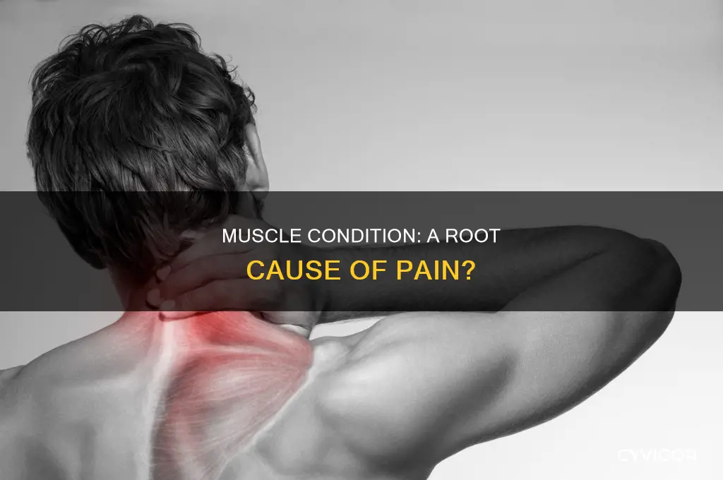 Muscle Condition: A Root Cause Of Pain? | CyVigor
