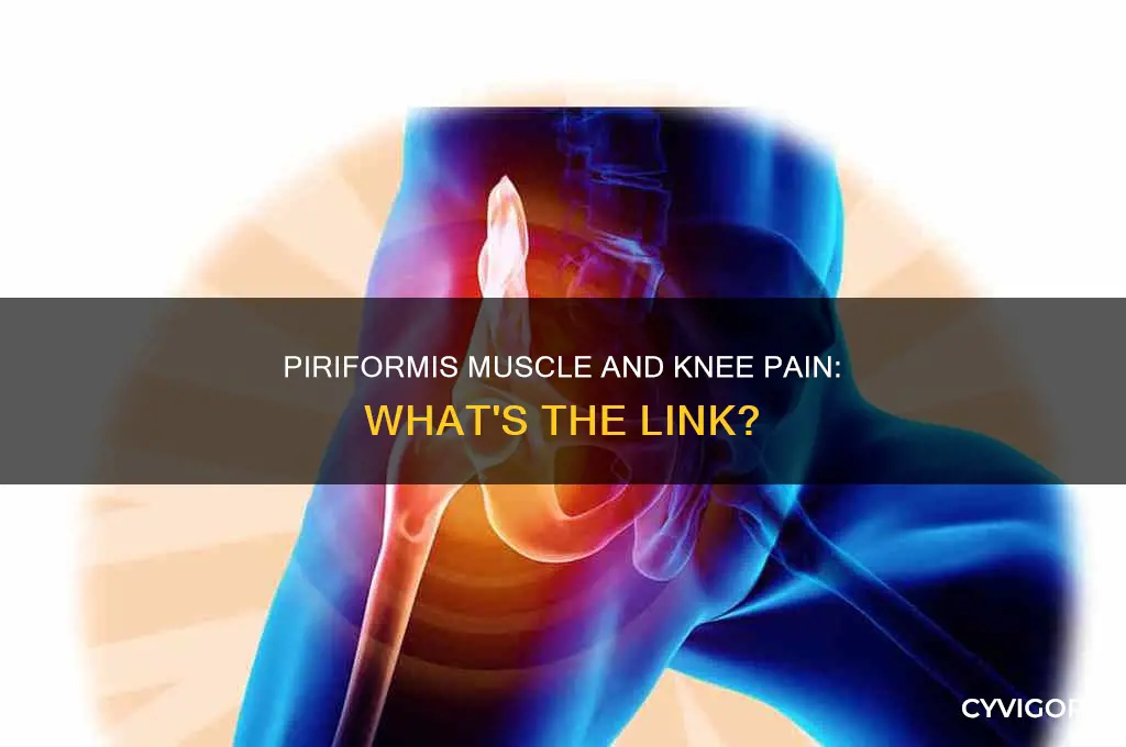 Piriformis Muscle And Knee Pain: What's The Link? | CyVigor