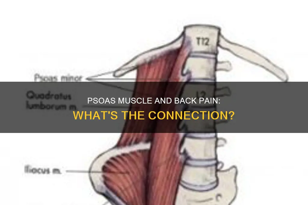 Psoas Muscle And Back Pain: What's The Connection? | CyVigor