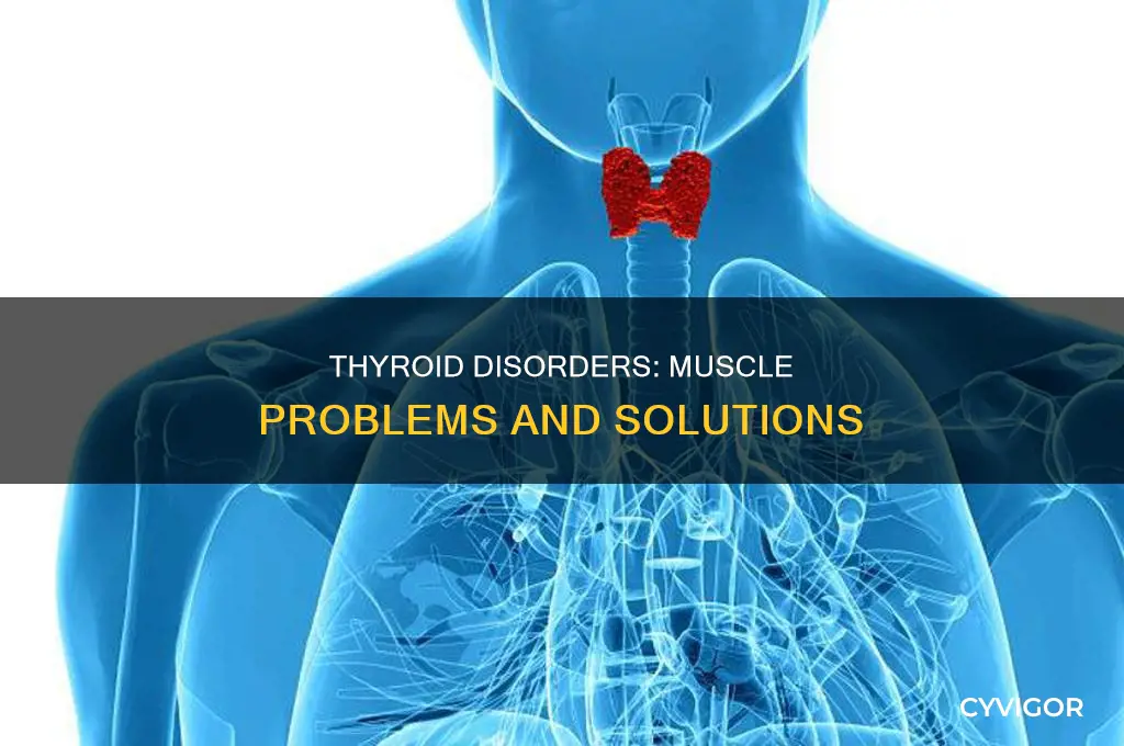 Thyroid Disorders: Muscle Problems And Solutions | CyVigor