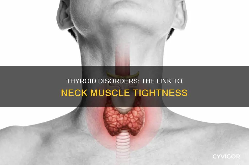 Thyroid Disorders: The Link To Neck Muscle Tightness | CyVigor