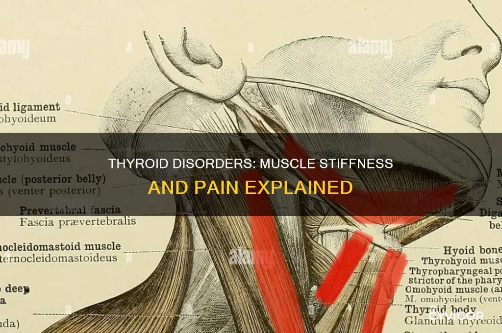 Thyroid Disorders: Muscle Stiffness And Pain Explained | CyVigor